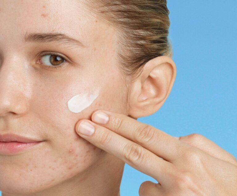 Ask Dr. Baynham: Tween and Teen Acne - PDX Parent